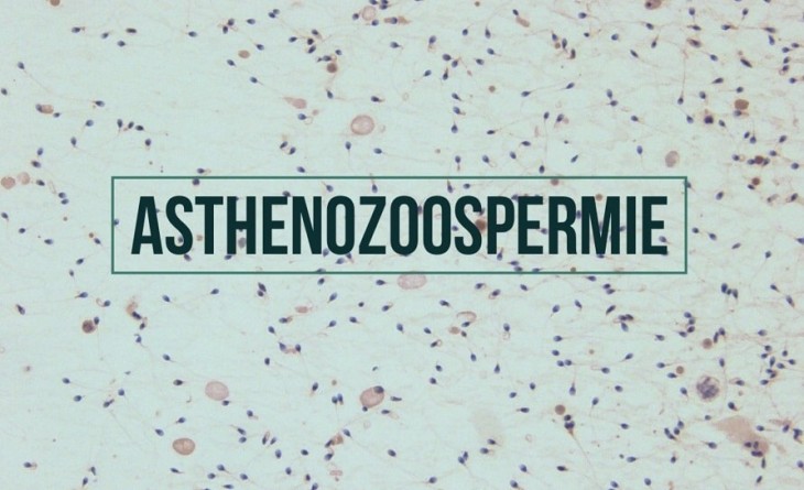 Asthénospermie - Actualités - Sante-dz