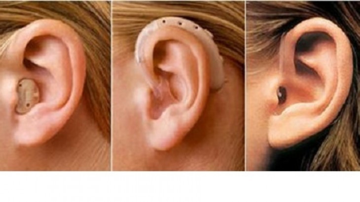 La prothèse auditive - Conseils - Sante-dz