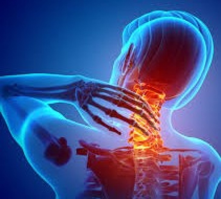 Comprendre la cervicalgie - Conseils - Sante-dz